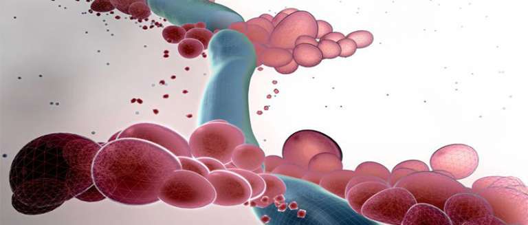 INTERTRIGO, afectiune usoara dar cu complicatii serioase – Salus Media